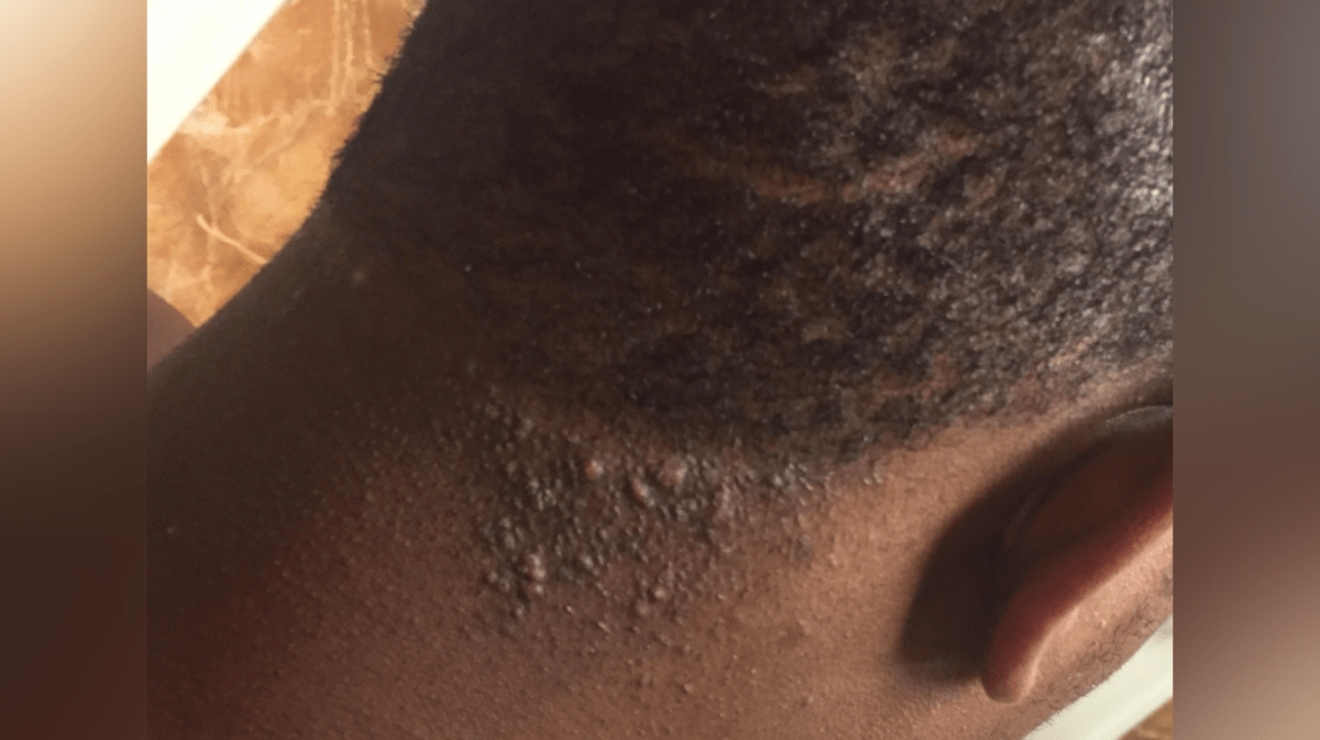 Environmental Health Officer Raises Awareness on Barbershop & Salon ...