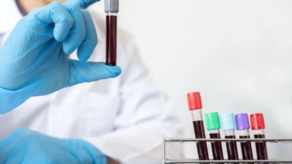 Ministry of Health Encourages Blood Donation – One News SVG